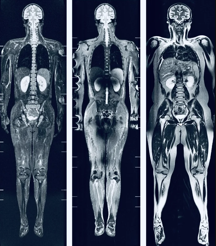Full Body MRI In Oregon Longevity Blog HormoneSynergy Full Body MRI In Oregon Longevity Blog HormoneSynergy